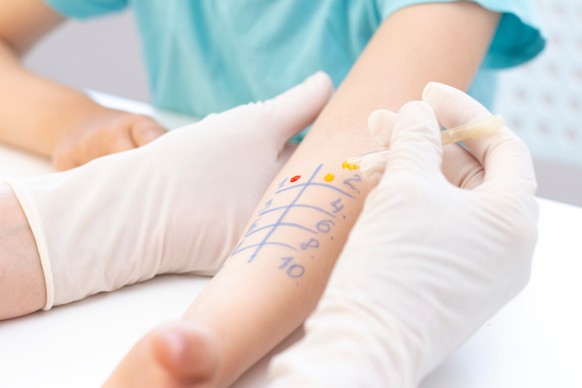 What Are the Different Types of Allergy Tests?